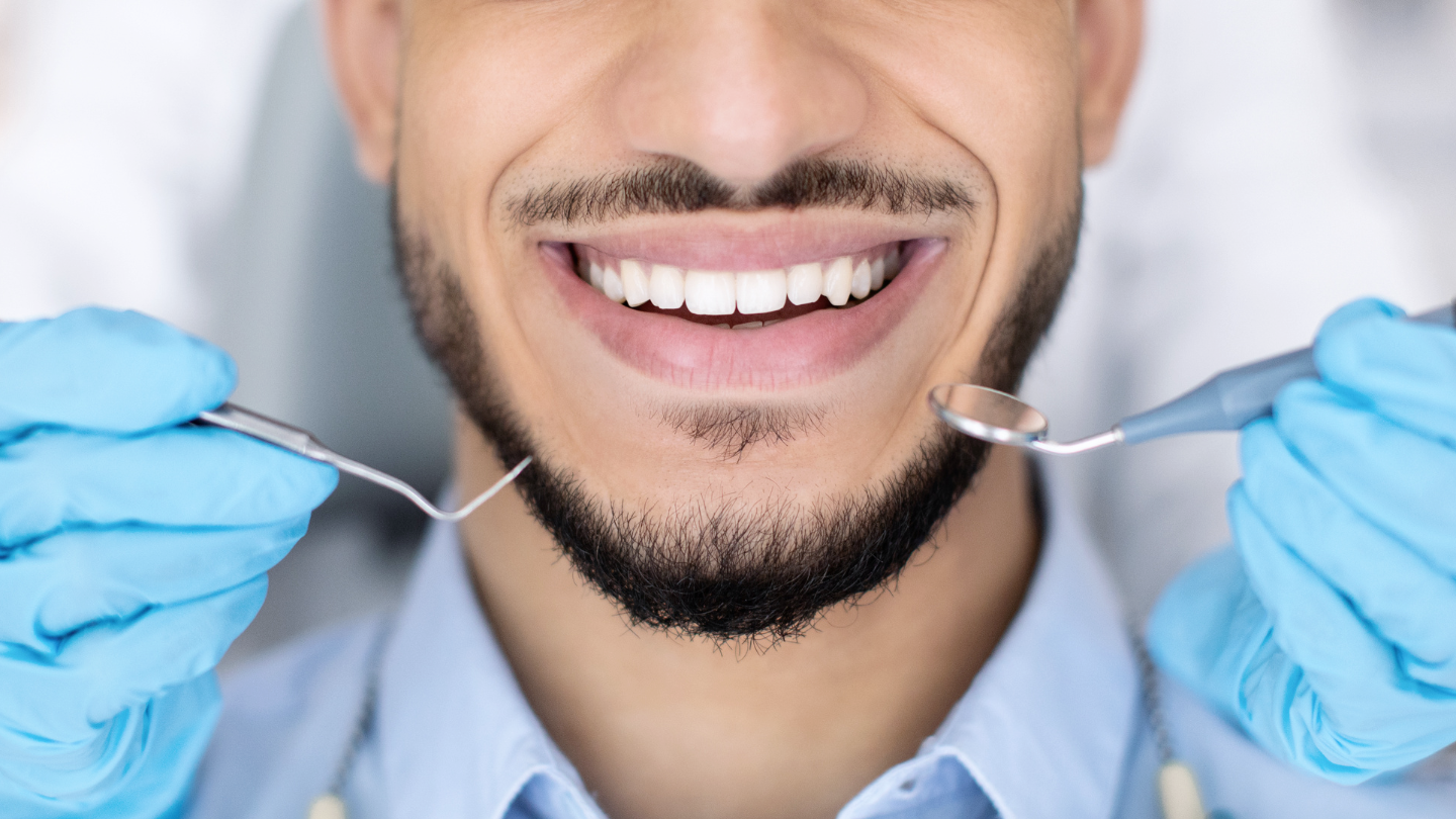 Smile Makeover FAQs | Dentist in Matthews NC | Matthews Family Dentistry